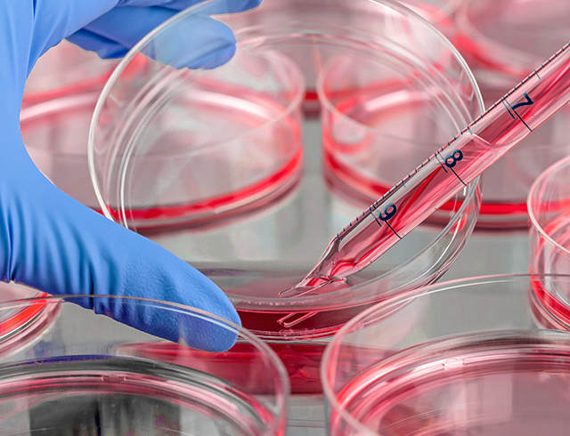 Custom Protein Service - Creative BioMart