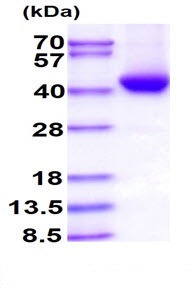 Recombinant Human ADH5 Protein, His-tagged ADH5-26H - Creative BioMart
