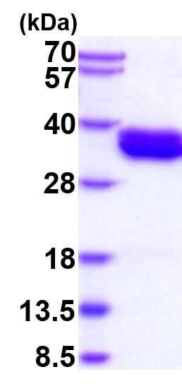 Recombinant Human BST1 Protein, His-tagged BST1-001H - Creative BioMart
