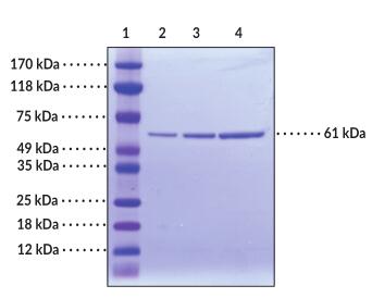 Recombinant Human CGAS Protein, His-tagged CGAS-019H - Creative BioMart