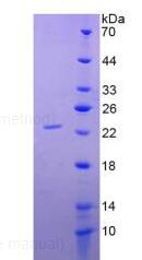 Recombinant Human COL17A1 Protein, His-tagged COL17A1-329H - Creative ...