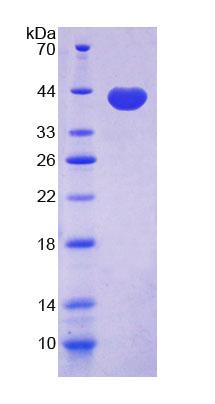 Recombinant Mouse Cdh5 protein, His & T7-tagged Cdh5-6863M - Creative ...