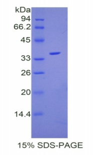 Recombinant Mouse F5 protein, His-tagged F5-769M - Creative BioMart