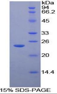 Recombinant Human GLB1 Protein, His-tagged GLB1-180H - Creative BioMart