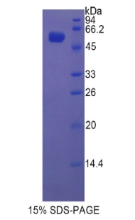 Recombinant Rat Gba protein, His & GST-tagged Gba-7843R - Creative BioMart