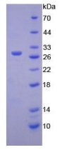 Recombinant Mouse Hexa Protein, His-tagged Hexa-179M - Creative BioMart