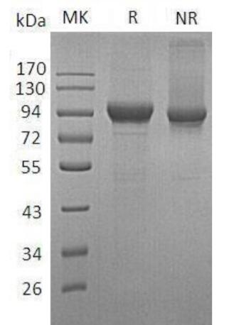 Recombinant Human MPO Protein, His-tagged MPO-51H - Creative BioMart