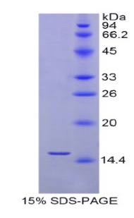 Recombinant Human MSRB1 protein, His-tagged MSRB1-1294H - Creative BioMart