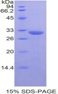 Recombinant Mouse Mapk8 protein, His & T7-tagged Mapk8-1550M - Creative ...