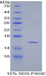 Recombinant Rat Ogn protein, His-tagged Ogn-7998R - Creative BioMart