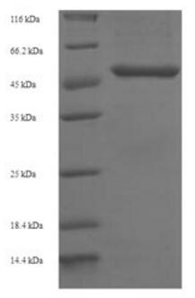 Recombinant Human QPCT Protein, His-SUMO-tagged QPCT-1347H - Creative ...
