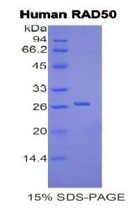 Recombinant Human RAD50 protein, His-tagged RAD50-1744H - Creative BioMart