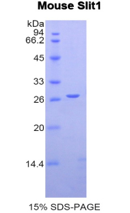 Recombinant Mouse Slit1 protein, His-tagged Slit1-7995M - Creative BioMart