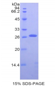 Recombinant Human TFRC protein, His & S-tagged TFRC-1566H - Creative ...