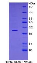 Recombinant Rhesus monkey TNFSF13 protein, His-tagged TNFSF13-25R ...
